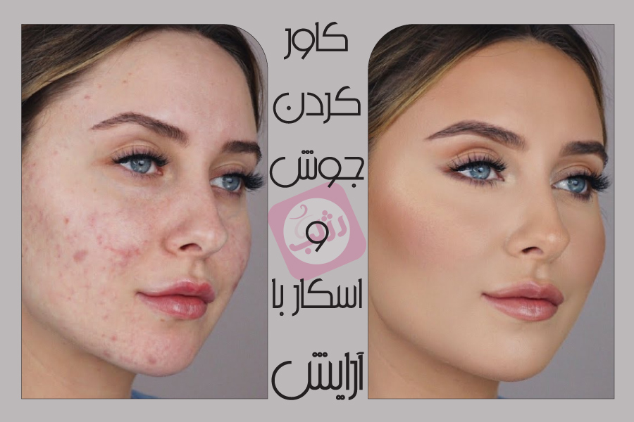 کاور کردن جوش و اسکار با آرایش رژلب